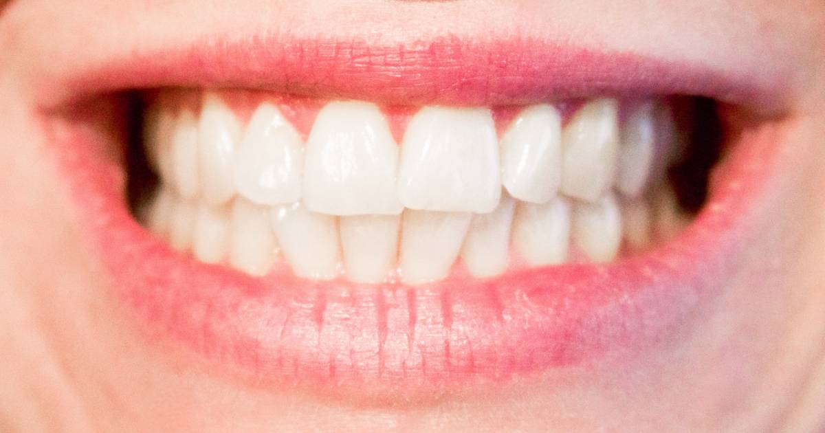 Conceptos para entender cómo es tu boca. El diente. - Clínica Rehberger ...